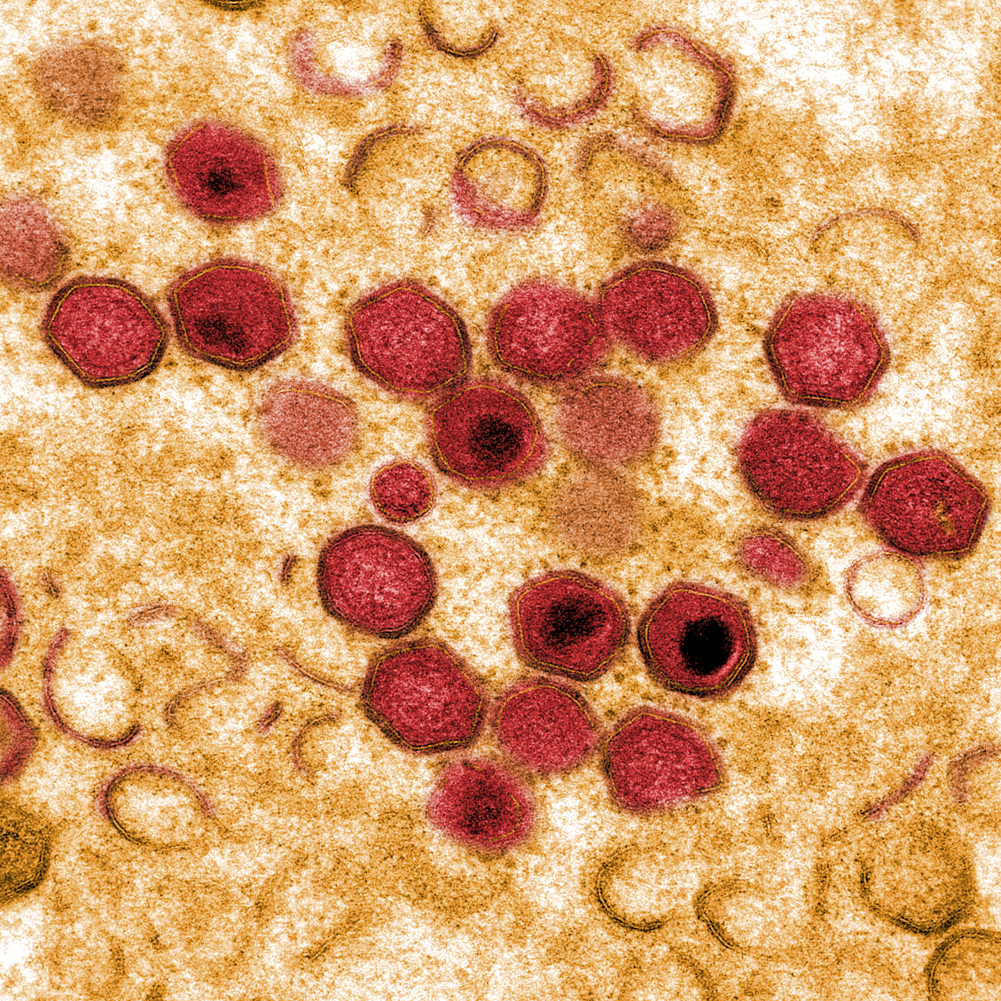 African swine fever virus | Virus | The Pirbright Institute