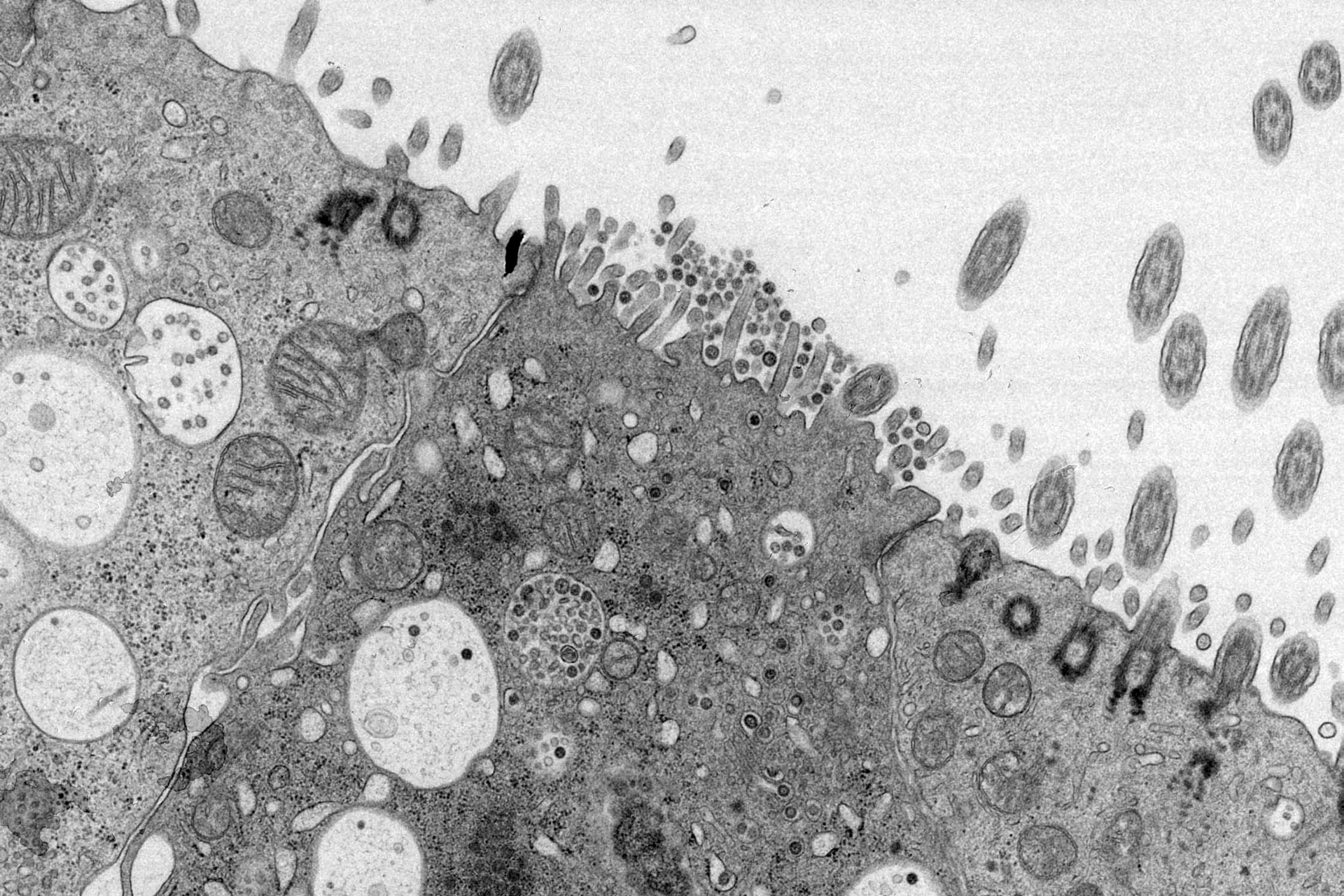 Infectious bronchitis virus (IBV): eLearning | The Pirbright Institute