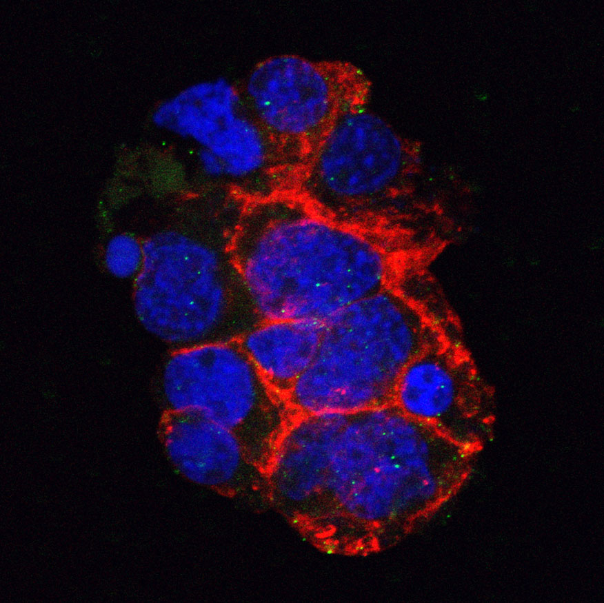 Laboratory diagnosis of lumpy skin disease (LSD): Instructor-led | The ...