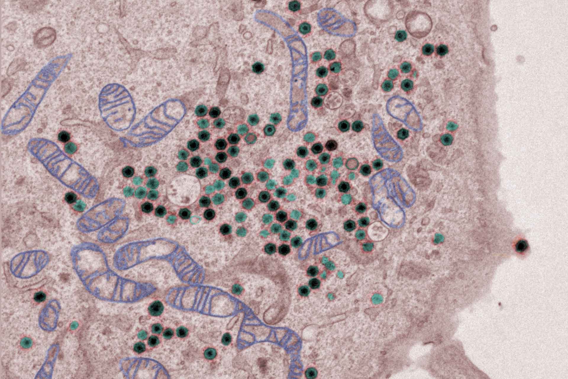 African swine fever virus interactome (ASFVint) | Research project ...