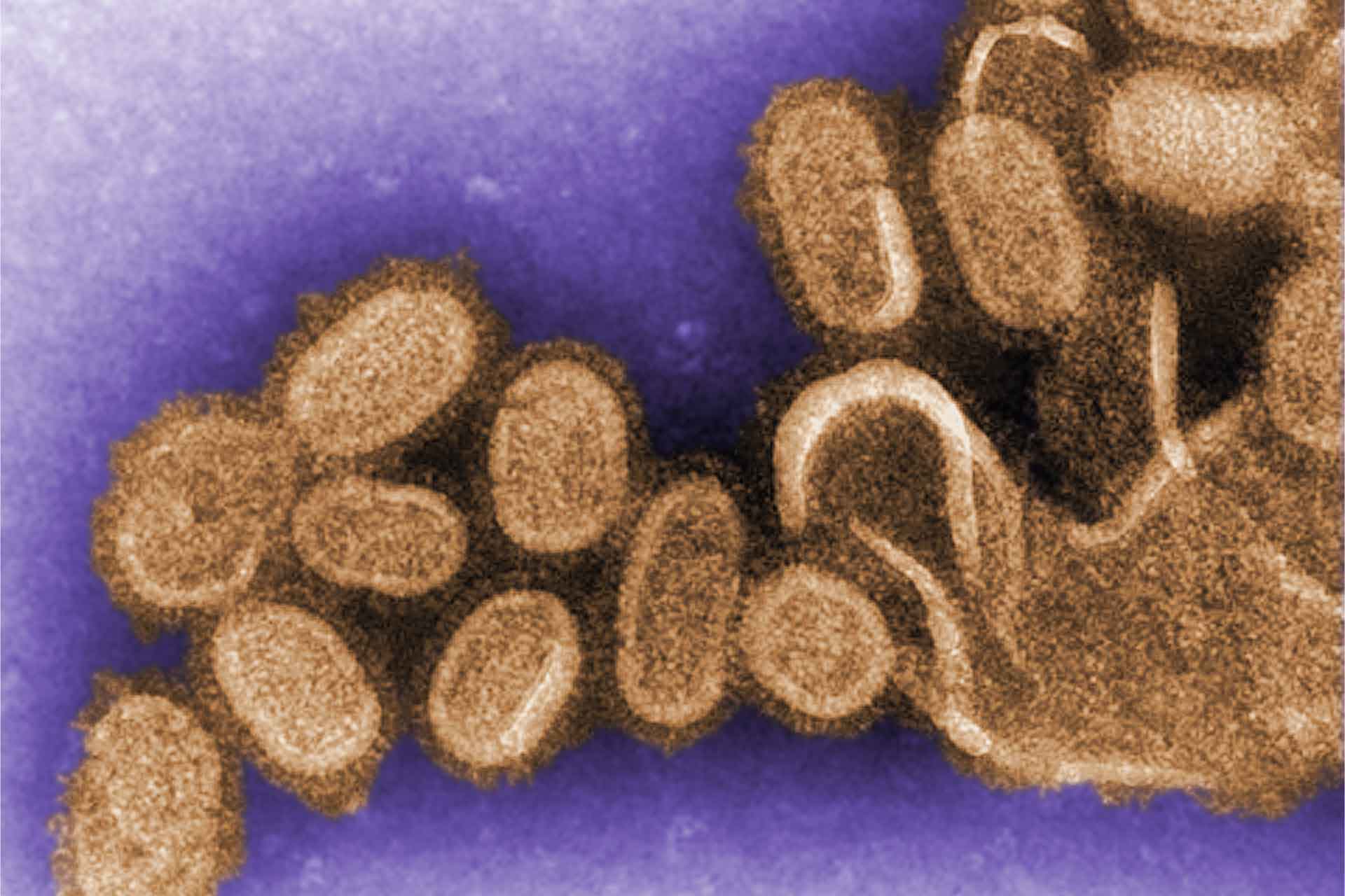 Pandemic threat to humans from common bird flu virus H9N2 better ...