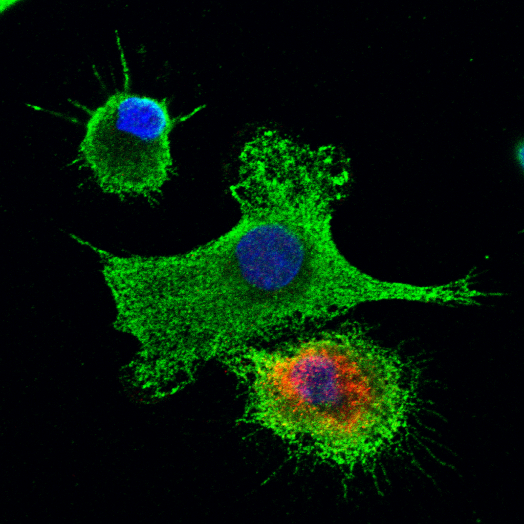 Paving the way for rapid detection of vector-borne viruses | News | The ...