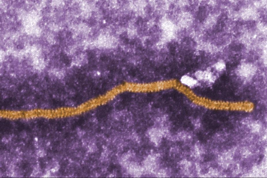 New study brings vaccine hopes for deadly Nipah virus | News | The ...